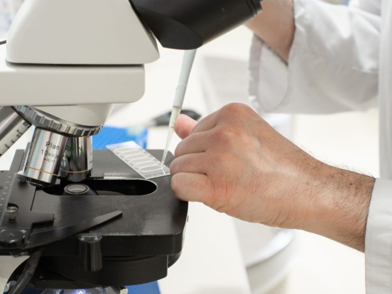 Sperm Analysis Technologies - Spermlide